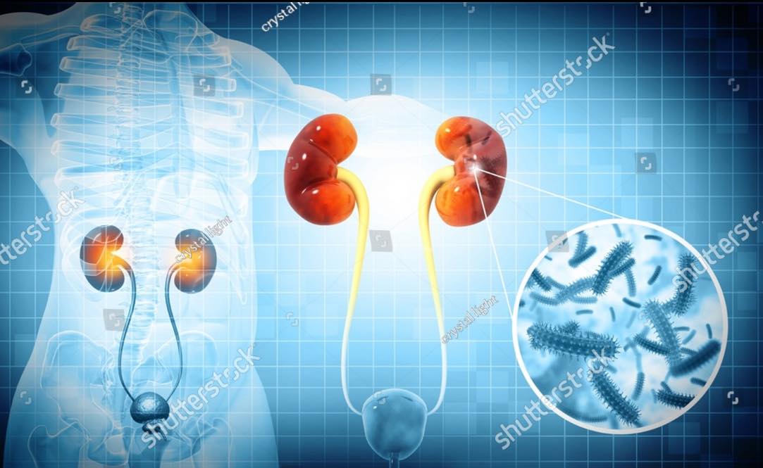 What is Chronic Kidney Disease (CKD)? – Kidney Foundation PH
